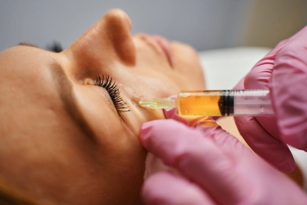 Platelet-Rich Plasma for Under Eyes | Graceful Glow